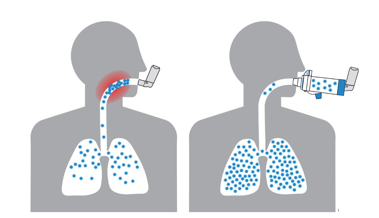 AEROCHAMBER PLUS* FLOW-VU* VHC Demo Kit | trudellmed.com