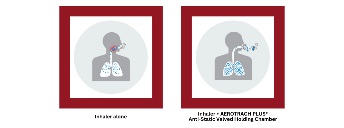 AEROTRACH PLUS* Anti-Static Valved Holding Chamber | trudellmed.com