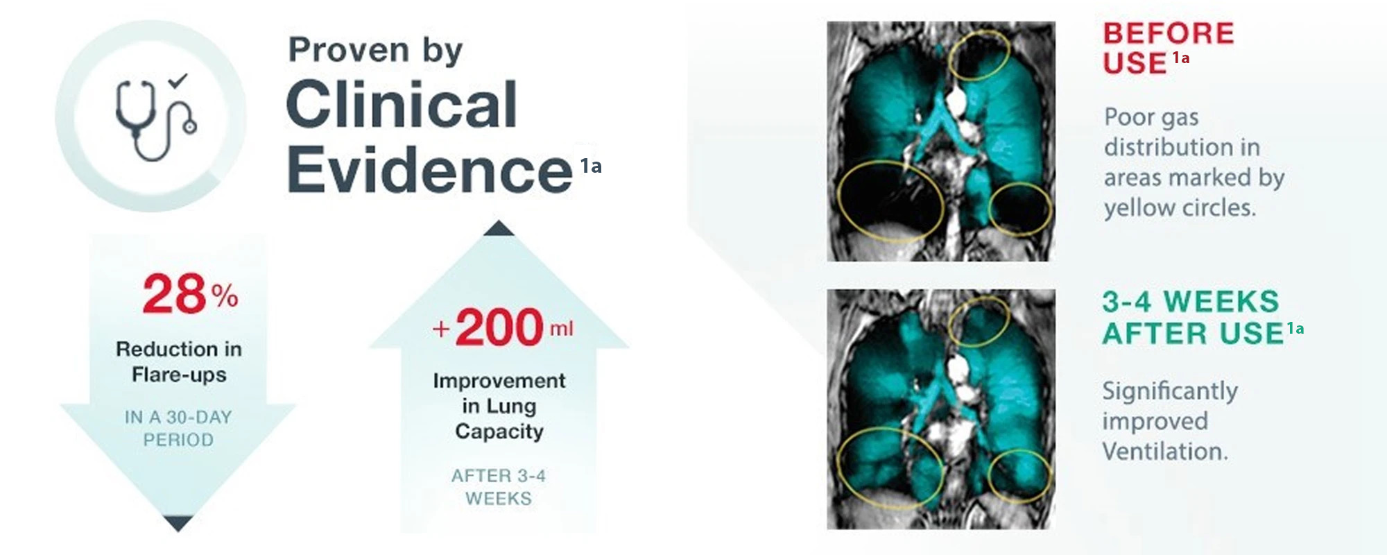 AEROBIKA* OPEP Device | trudellmed.com
