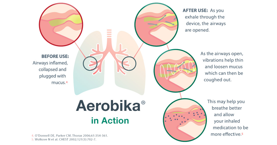 AEROBIKA* OPEP Device | trudellmed.com